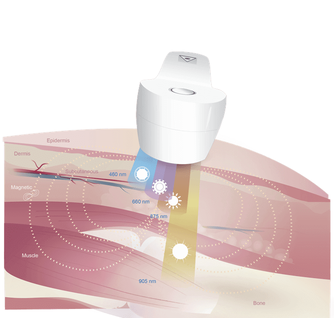 MR5 ACTIVet Pro Laser - Multi Radiance Medical - Dispomed