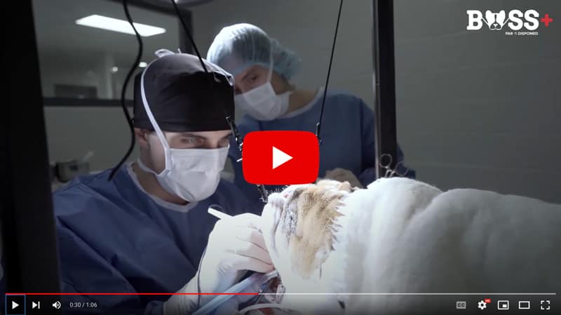obstructive airway syndrome corrective surgery
